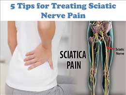 5 Tips for Treating Sciatic Nerve Pain.pptx PowerPoint Presentation PPT
